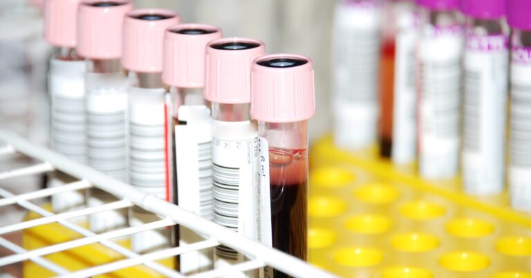 Prise de sang et cancer : quels marqueurs tumoraux recherche-t-on et ...