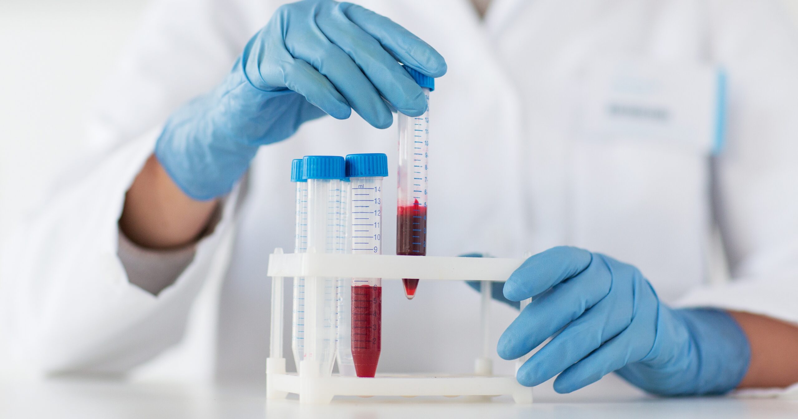 Plaquettes et prise de sang : comprendre les valeurs normales et gérer ...